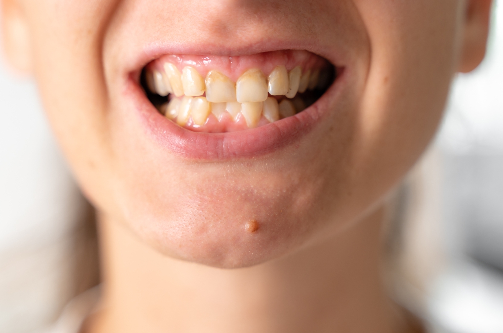 Men Reveal Their Biggest Beauty Icks And Turn-Offs On Women